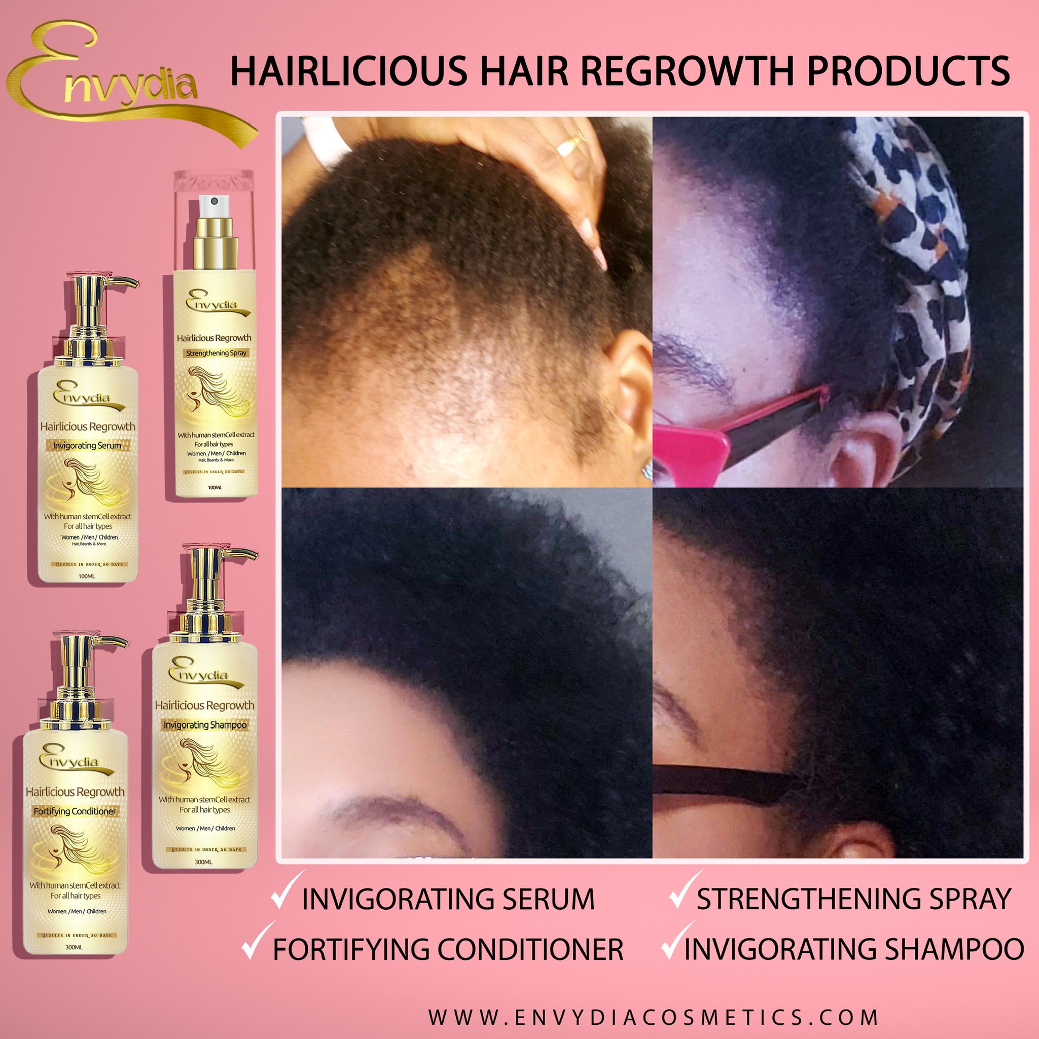 HAIR GROWTH & REGROWTH PRODUCTS – Whitenicious