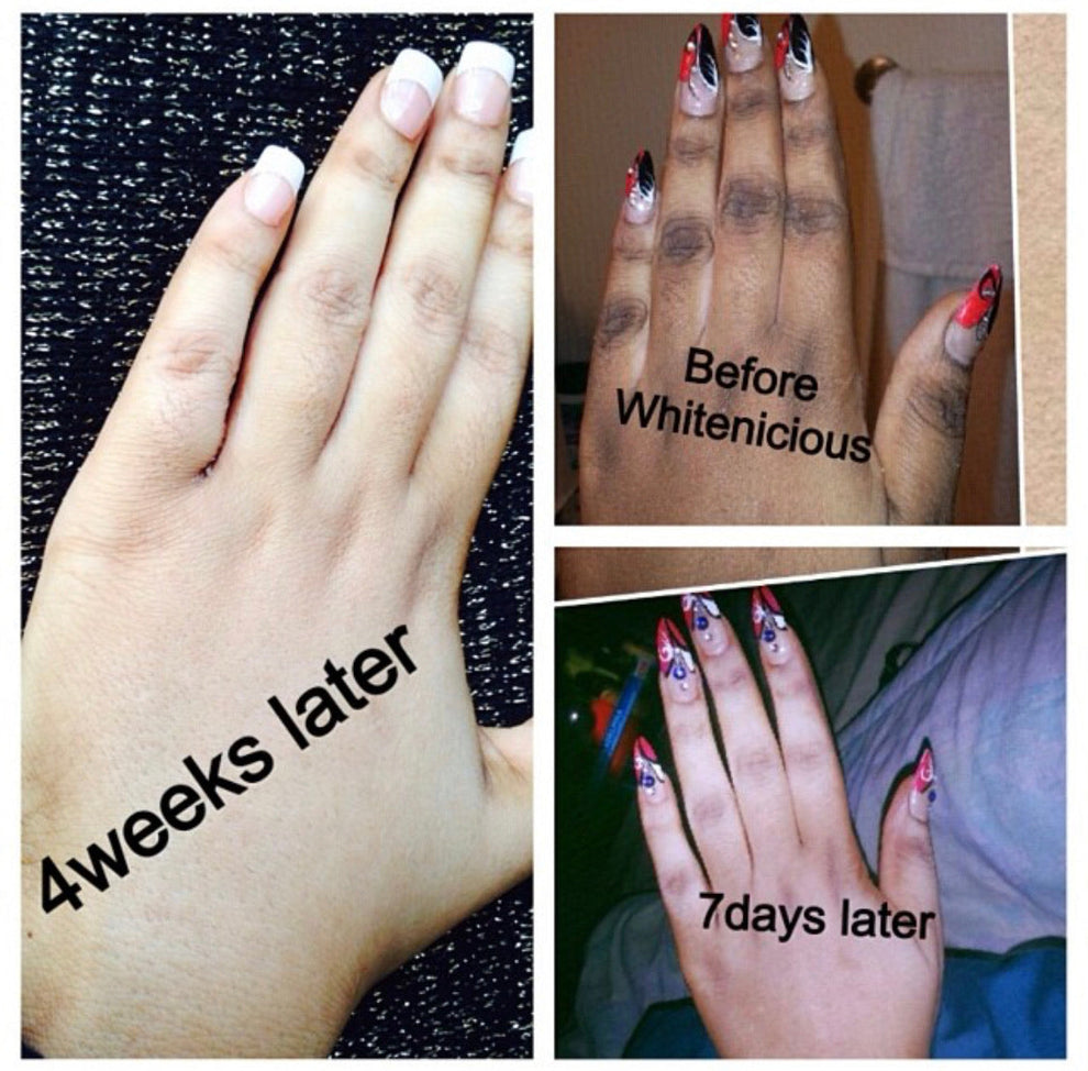 Dark Knuckles,Knees & Elbows Eraser Creme – Whitenicious