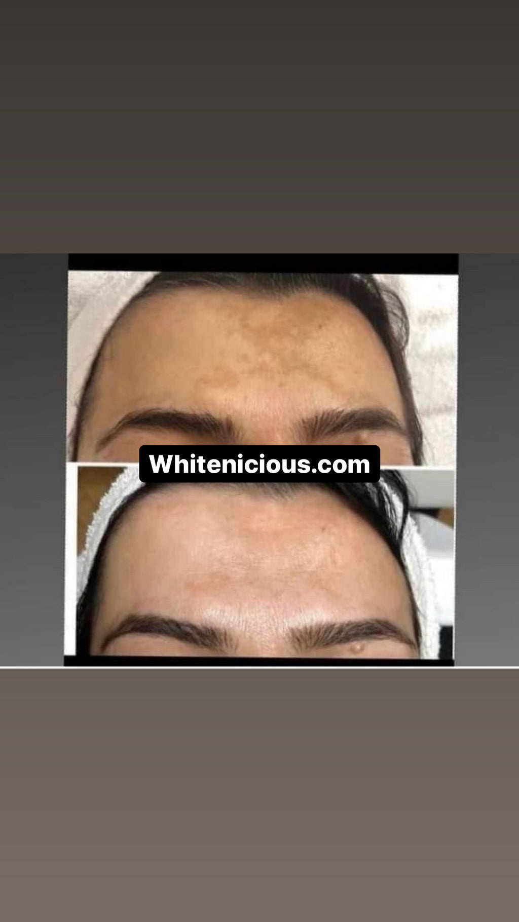 Fast Acting Dark Spot Remover 60G – Whitenicious By Dencia