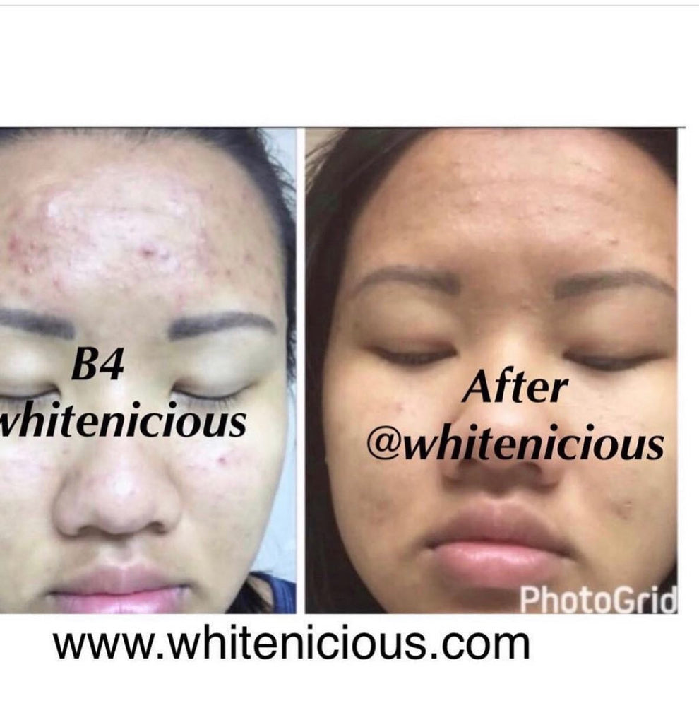 Whitenicious Fast Acting Dark Spot Remover 30G