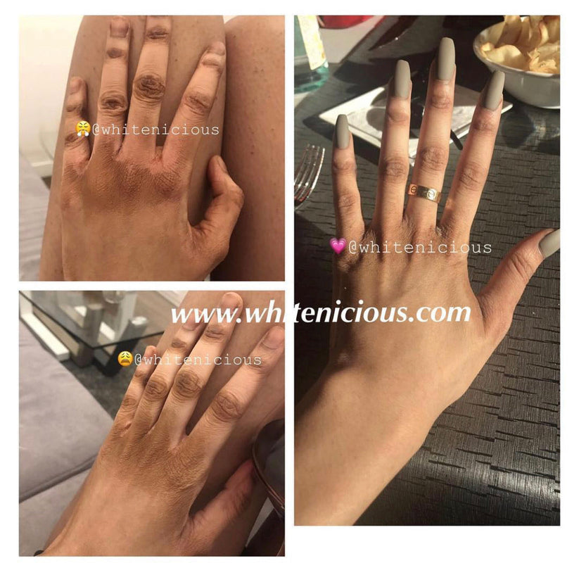 Dark Knees,knuckles & Elbows Lightening cream- 60G – Whitenicious